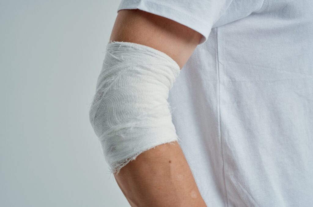 Rio Rancho Burn Injuries Lawyer - Lerner and Rowe Injury Attorneys