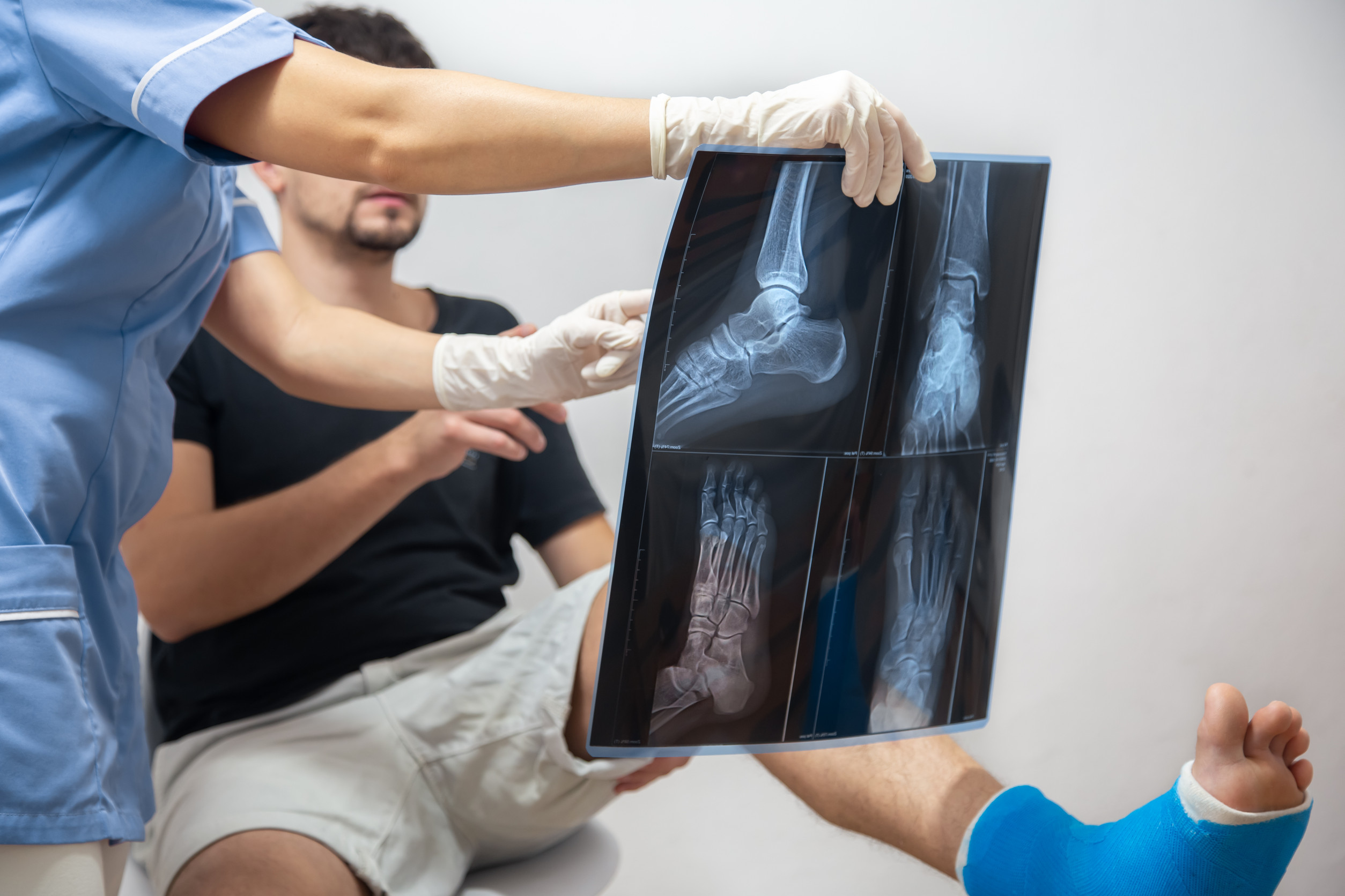 Hobbs Bone Fractures Lawyer - Lerner and Rowe Injury Attorneys